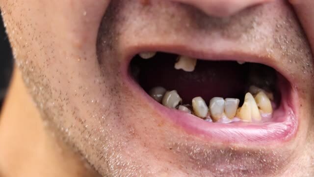 When God Breaks People's Teeth... | Cornerstone Church Clayton