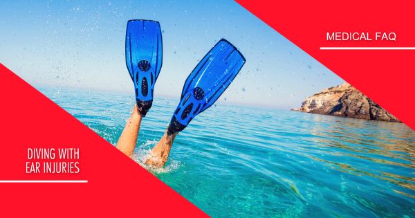 Diving with Existing Ear Injuries | DAN Southern Africa