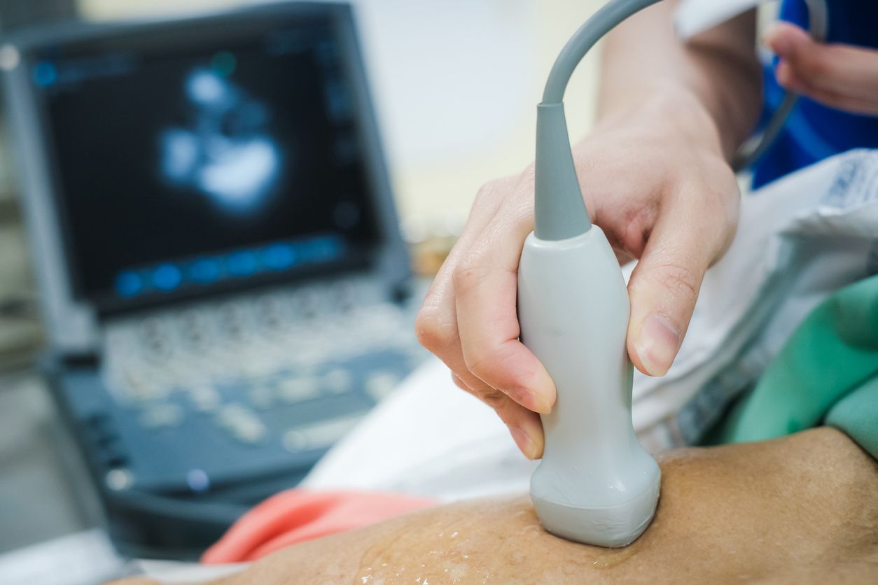 Exploring Decompression Bubbles Using Advanced Ultrasound Techniques ...